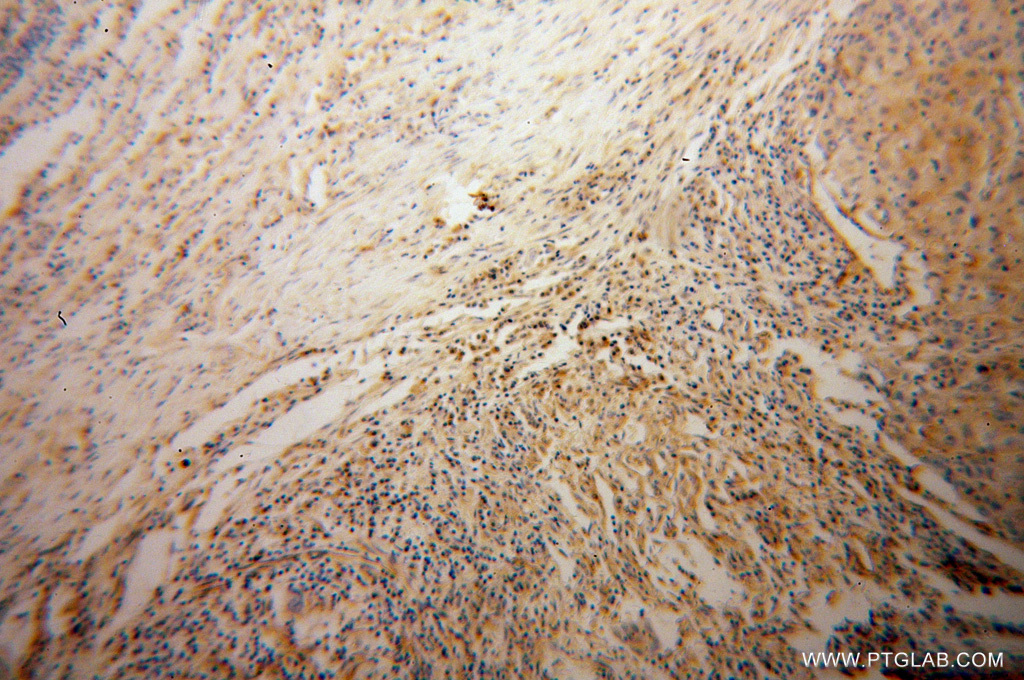 Syntaxin 12 Antibody 14259-1-AP | Proteintech