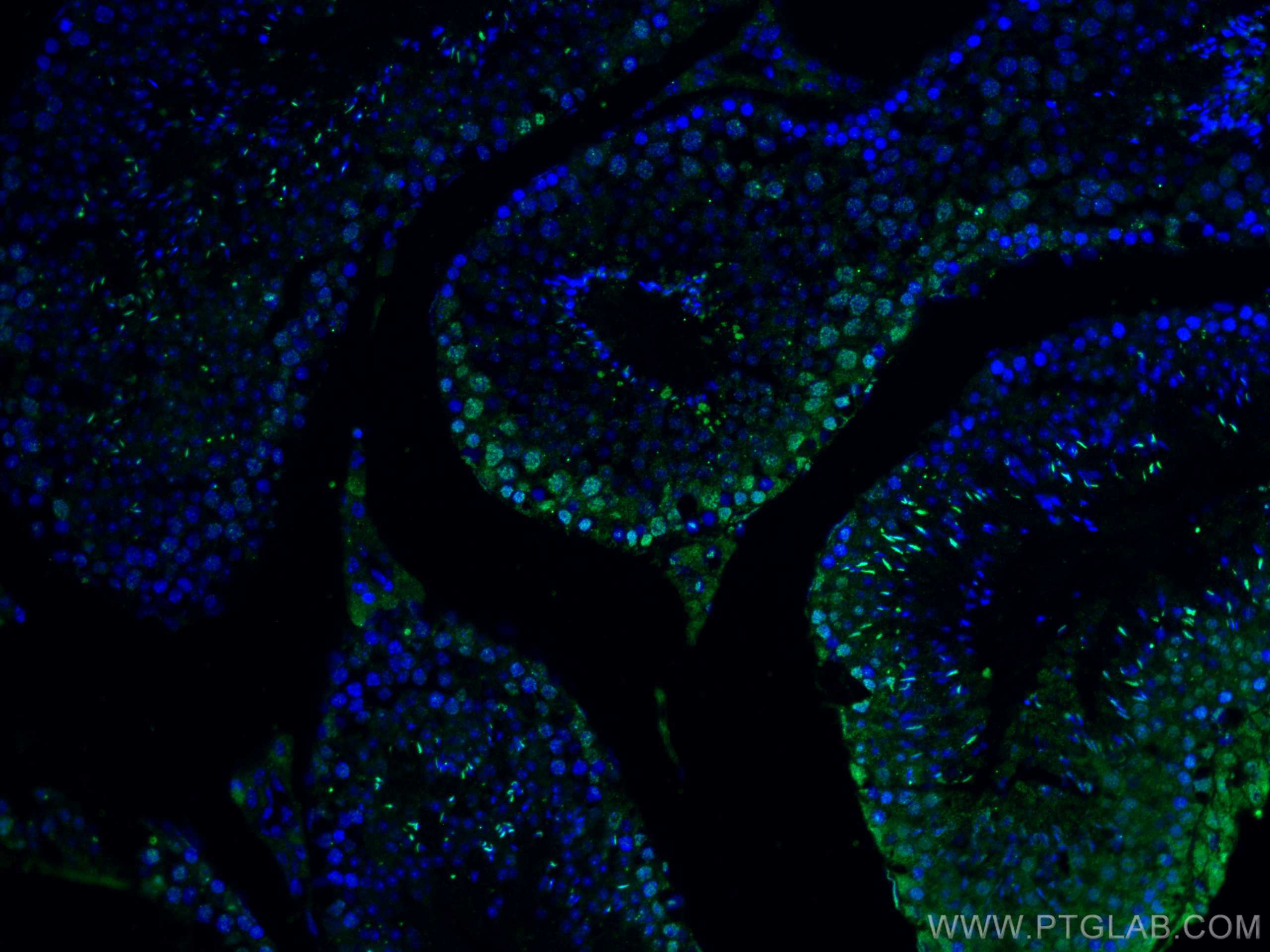SCP3 Antibody 23024-1-AP | Proteintech