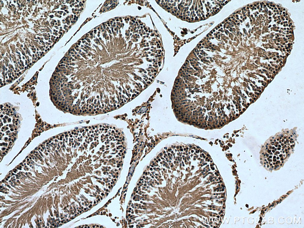 SCP3 Antibody 23024-1-AP | Proteintech
