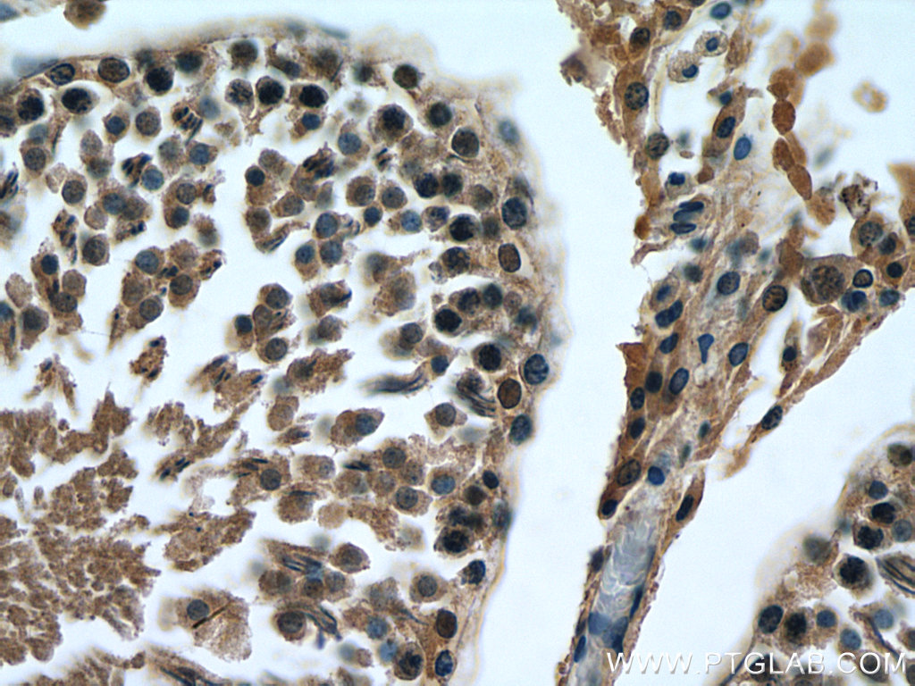 SCP3 Antibody 23024-1-AP | Proteintech