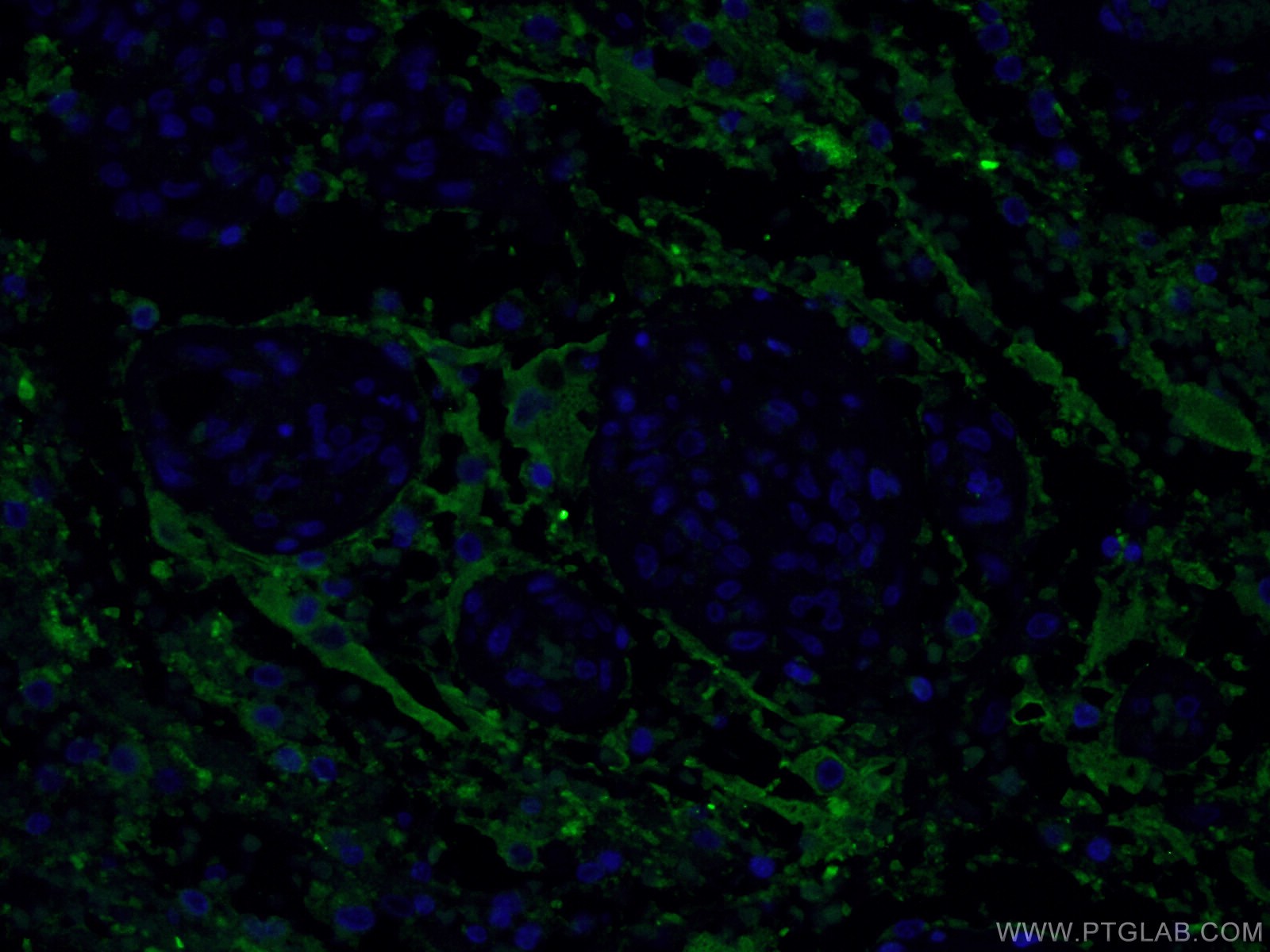 Synaptophysin Antibody 17785-1-AP | Proteintech