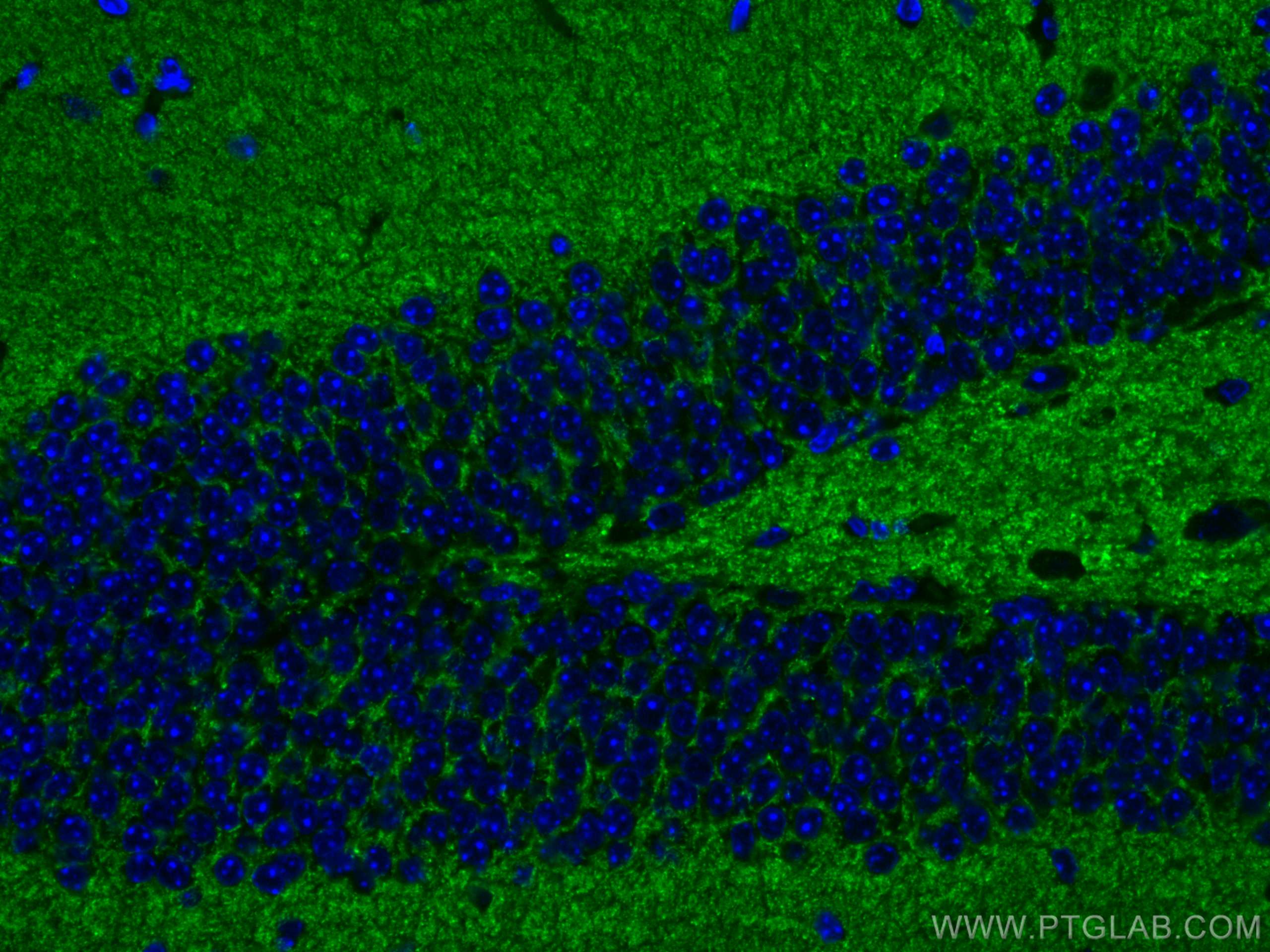 Synaptophysin Antibody CL488-67864 | Proteintech Synaptophysin Antibody CL488-67864 | Proteintech