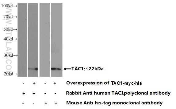 TAC1 Antibody 13839-1-AP | Proteintech