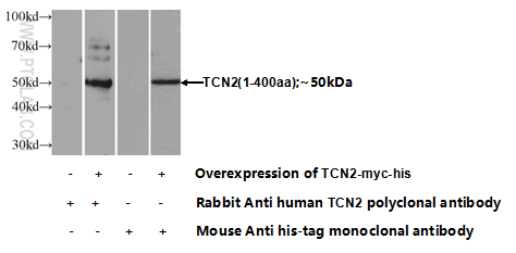 TCN2 Antibody 12157-1-AP | Proteintech