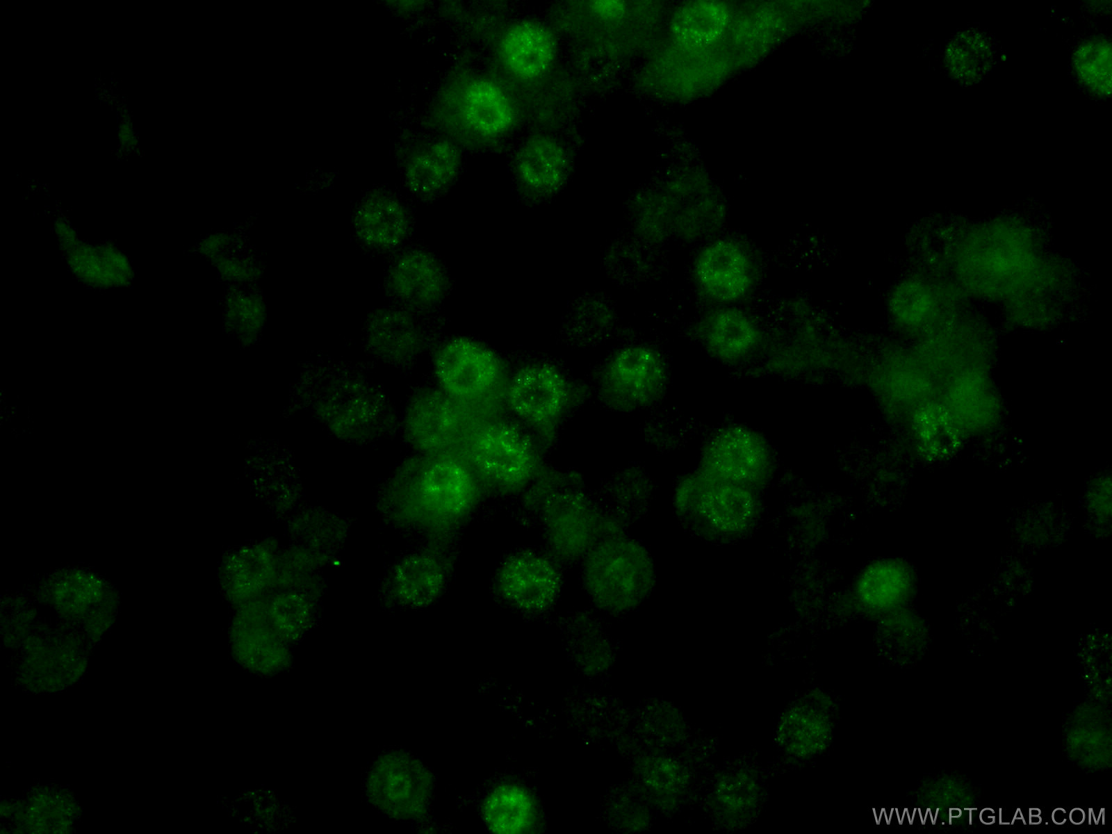TET2 Antibody 21207-1-AP | Proteintech