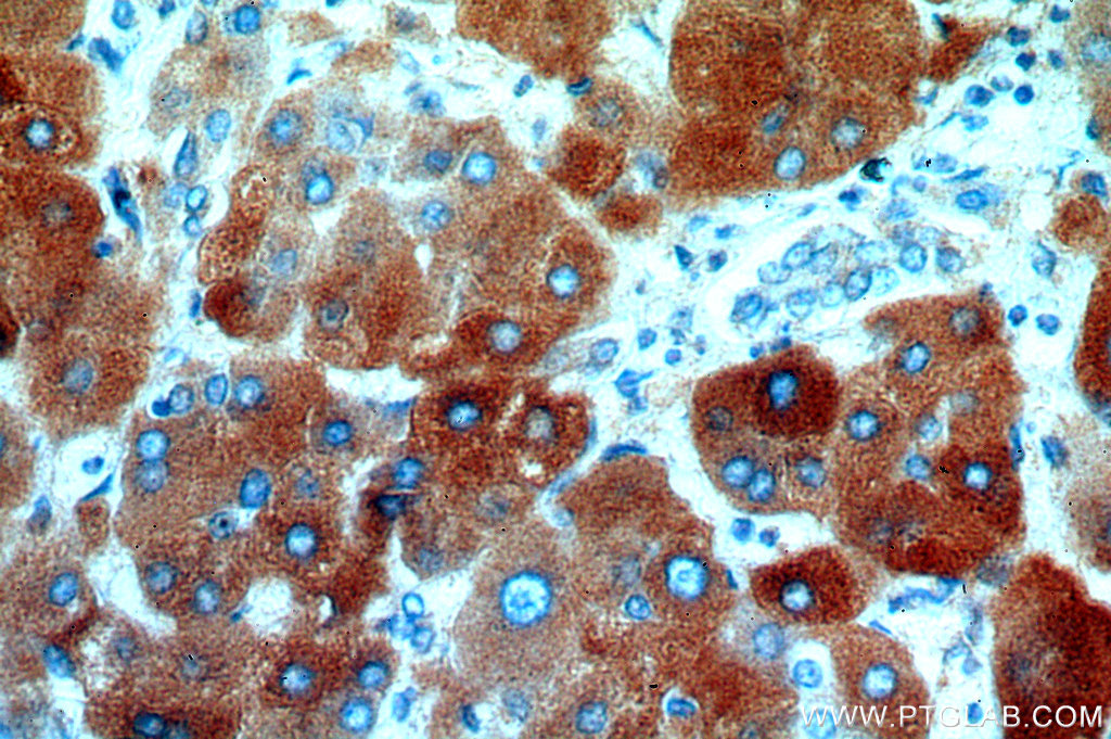 Transferrin Antibody 17435-1-AP | Proteintech