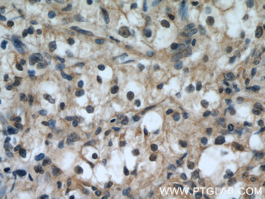 TFEB Antibody 13372-1-AP | Proteintech