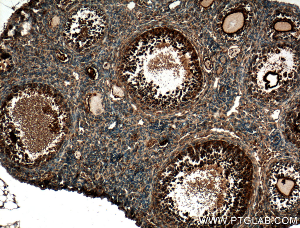 TGF-beta 1 Antibody 21898-1-AP | Proteintech