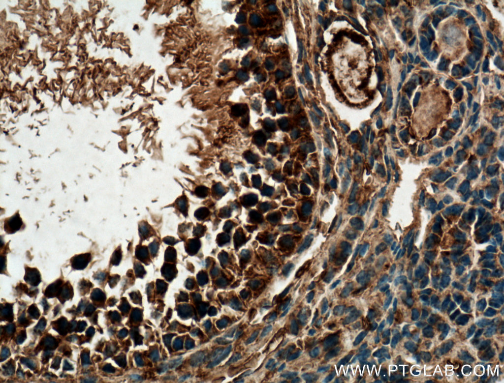 TGF-beta 1 Antibody 21898-1-AP | Proteintech