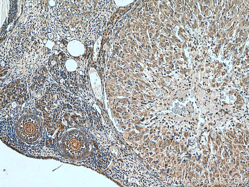 TGF-beta 1 Antibody 21898-1-AP | Proteintech