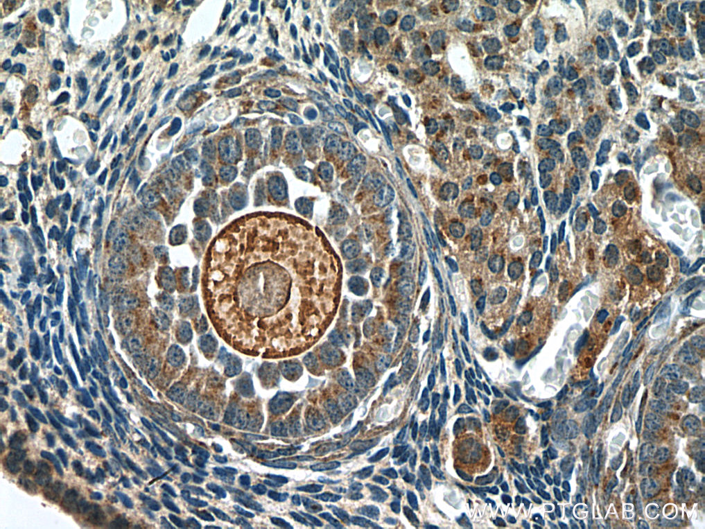 TGF-beta 1 Antibody 21898-1-AP | Proteintech