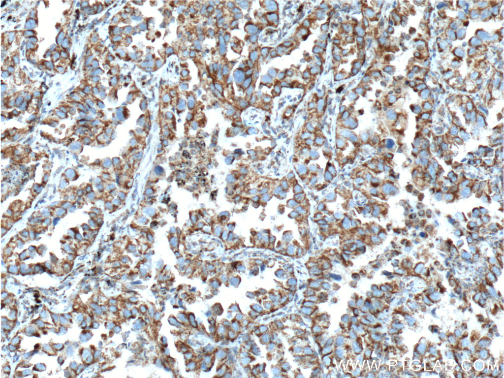 TGF Beta 1 Antibody 18978-1-AP | Proteintech