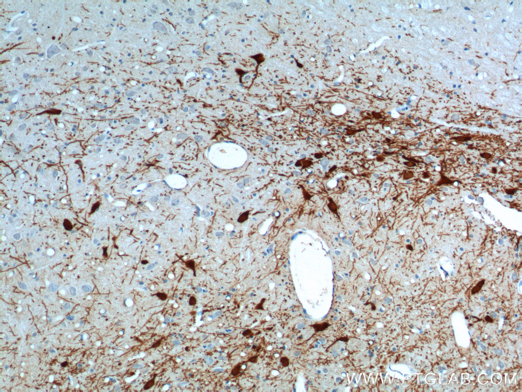 TH Antibody 25859-1-AP | Proteintech