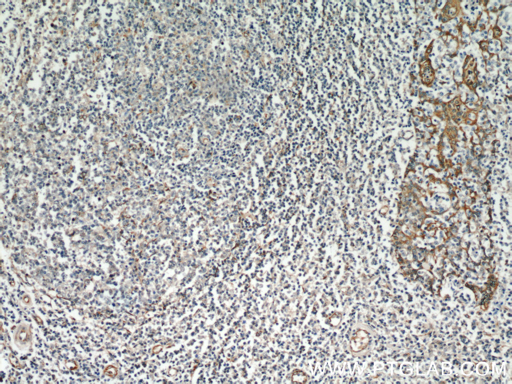 TMEM173/STING Antibody 19851-1-AP | Proteintech