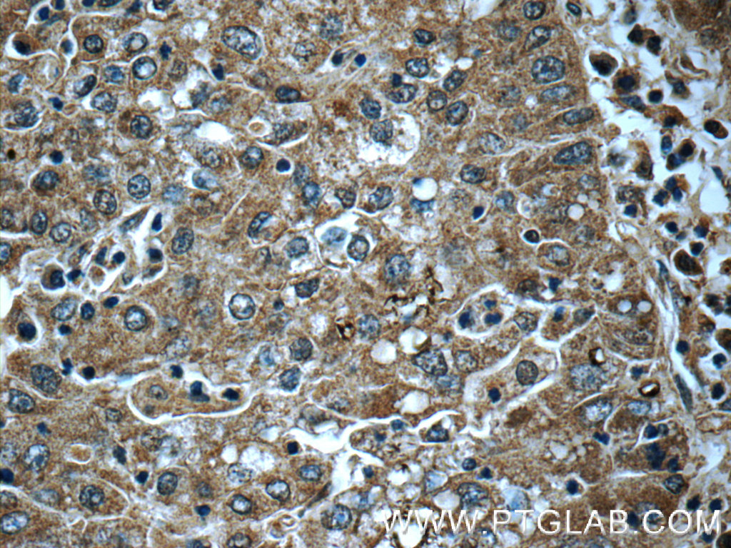 TNF Alpha Antibody 60291-1-Ig | Proteintech