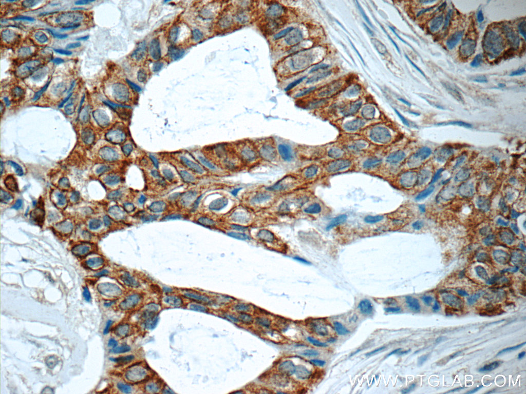 TNF alpha Antibody 60291-1-Ig | Proteintech
