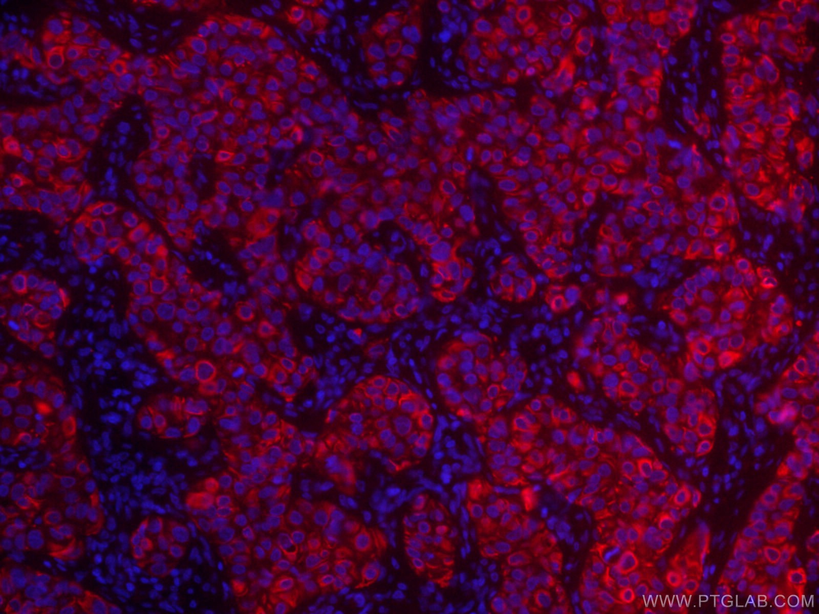 TNF Alpha Antibody CL594-60291 | Proteintech