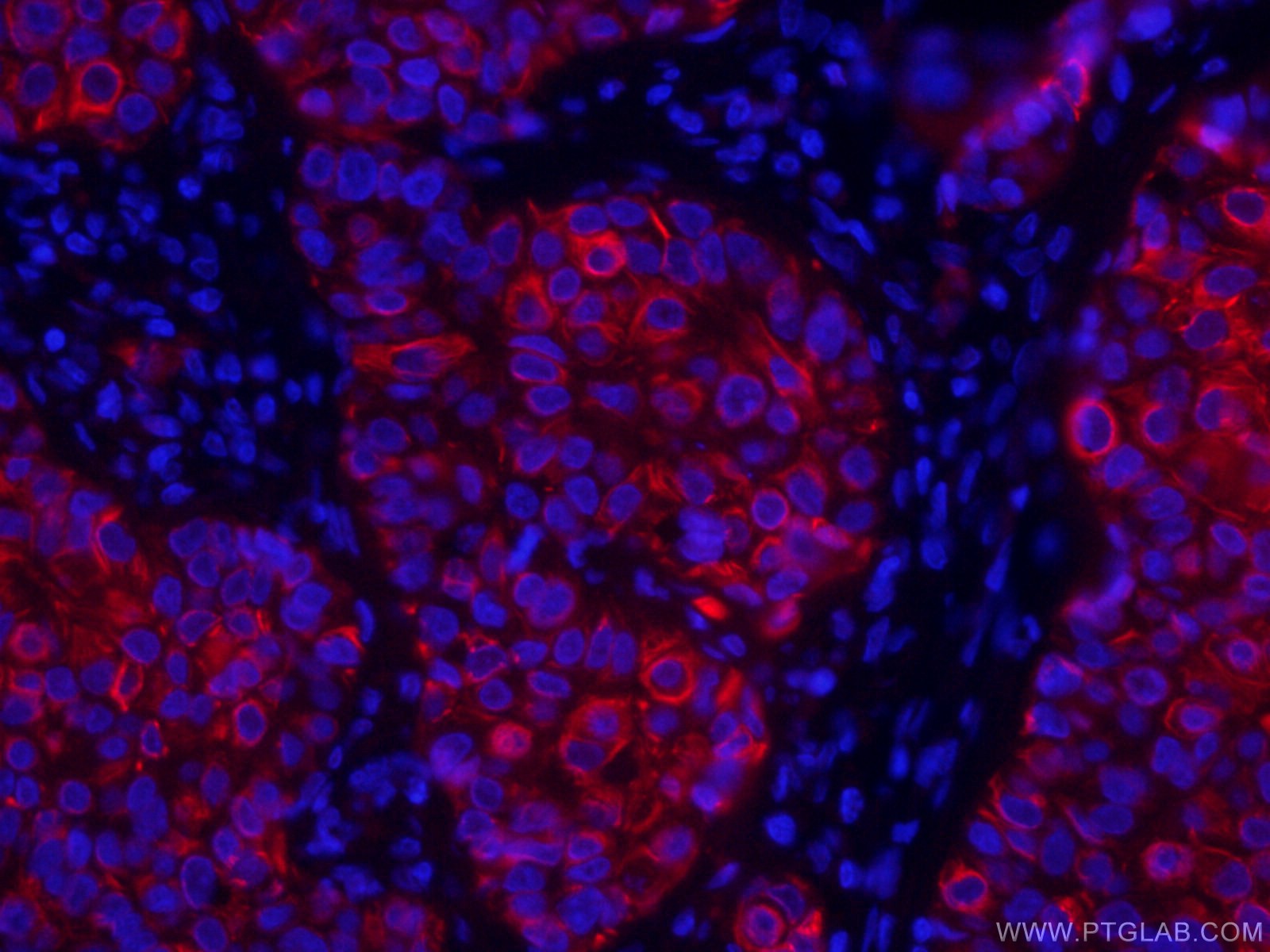 TNF Alpha Antibody CL594-60291 | Proteintech
