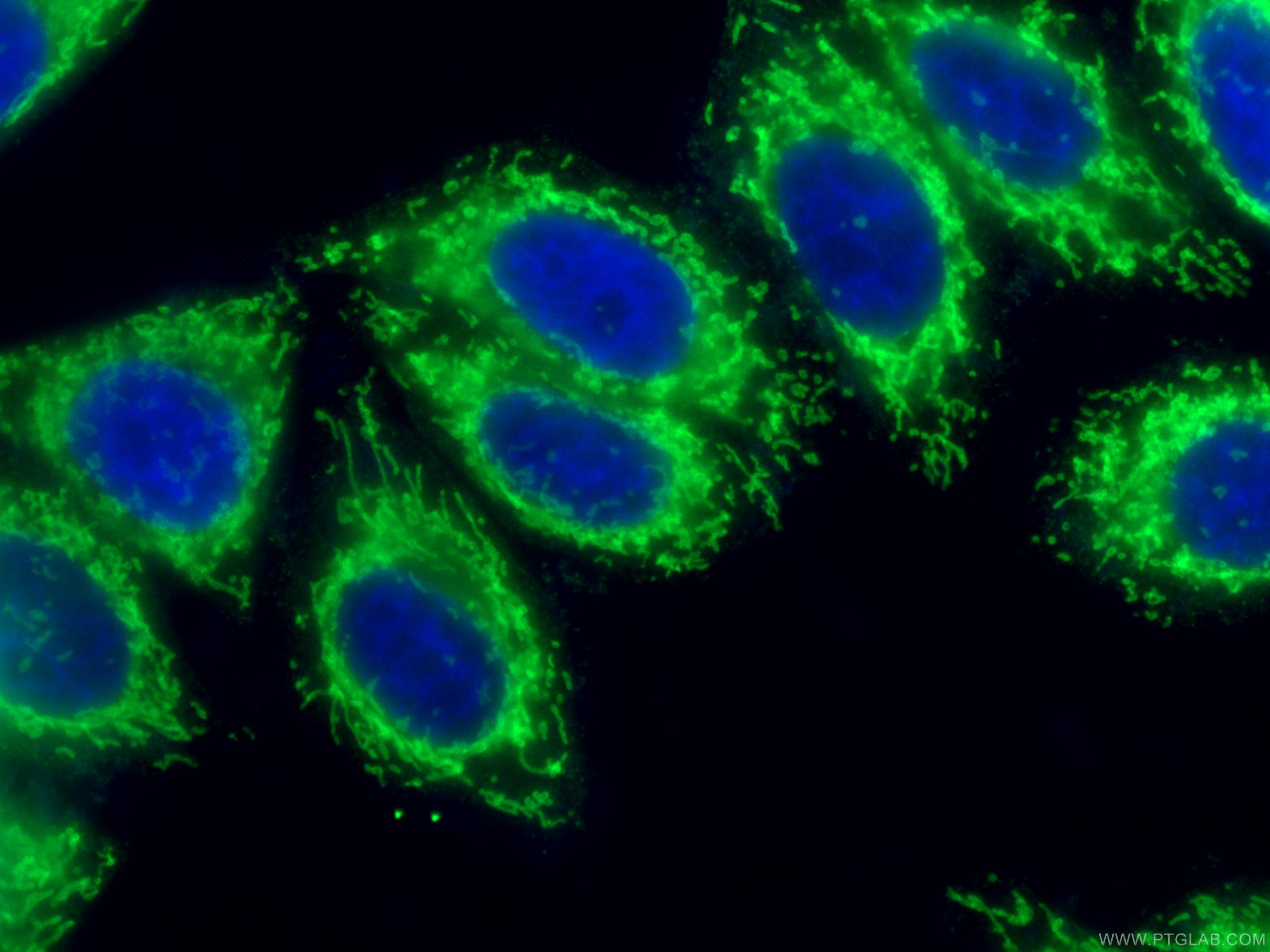 TOM20 Antibody 11802-1-AP | Proteintech