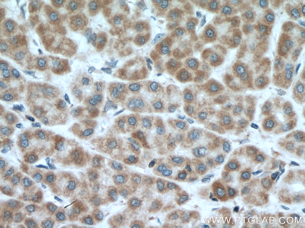 TOM20 Antibody 66777-1-Ig | Proteintech