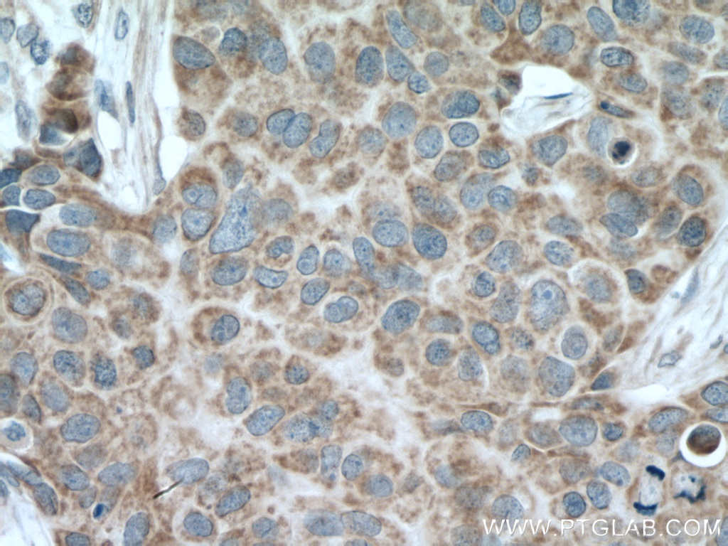 TOM20 Antibody 66777-1-Ig | Proteintech