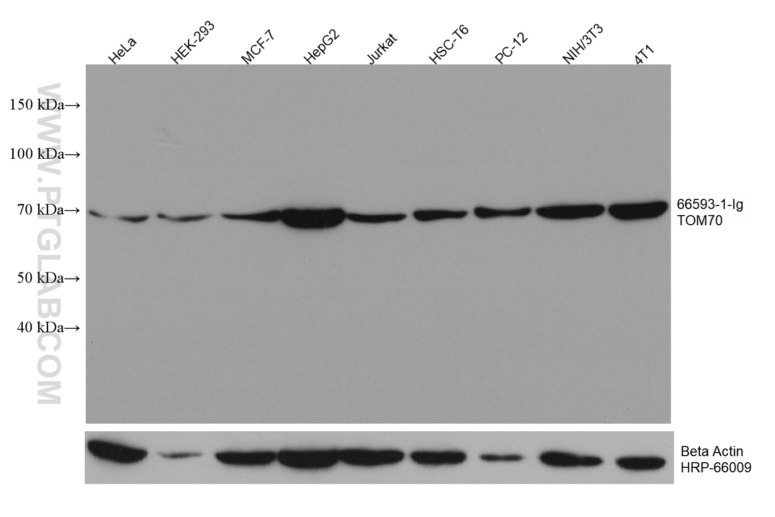TOM70 antibody (66593-1-Ig) | Proteintech | 武汉三鹰生物技术有限公司