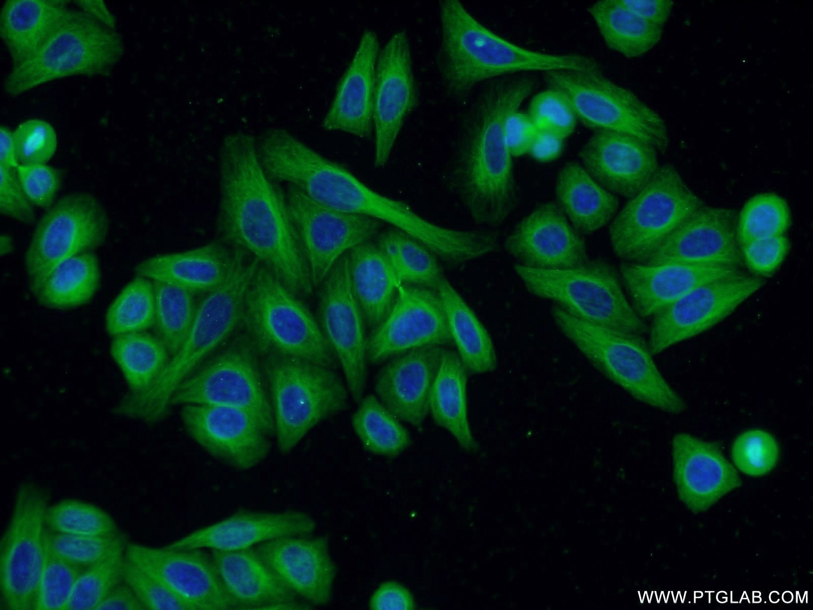 Beta Tubulin Antibody 66240-1-Ig | Proteintech