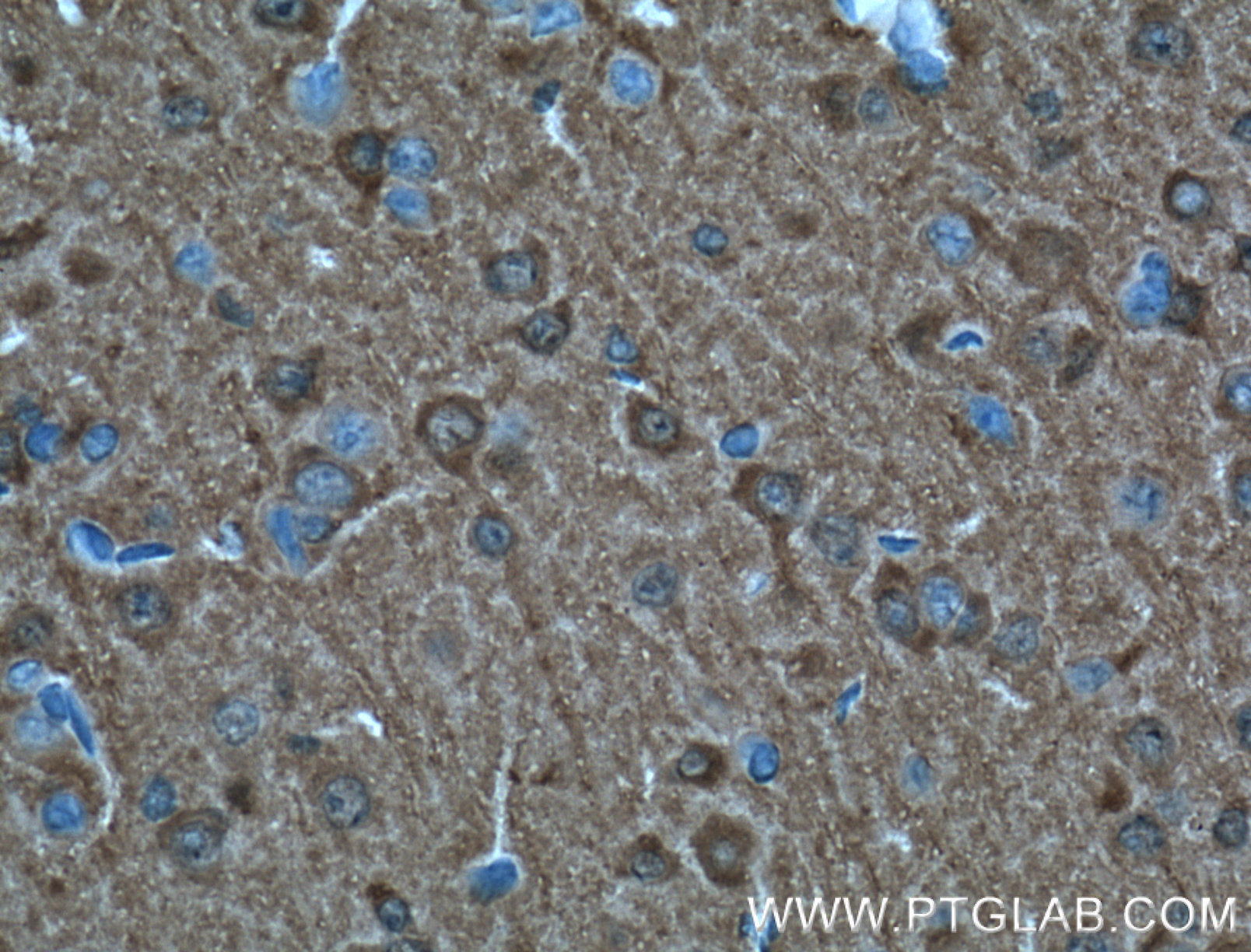UCHL1/PGP9.5 Antibody 14730-1-AP | Proteintech