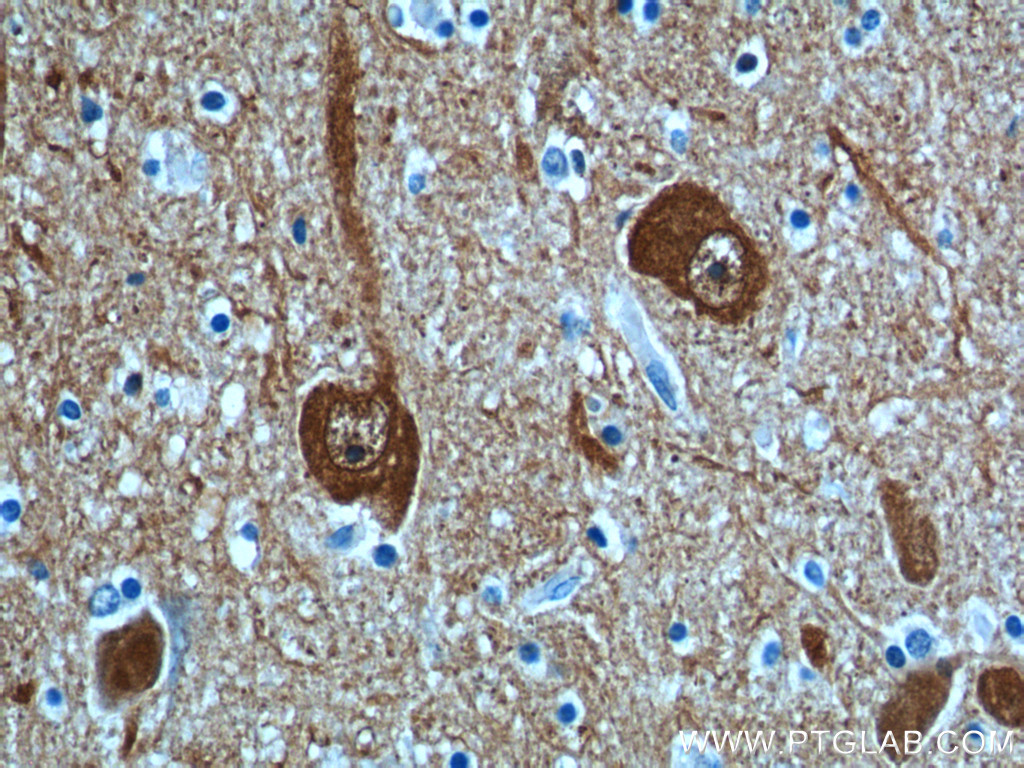 UCHL1/PGP9.5 Antibody 66230-1-Ig | Proteintech