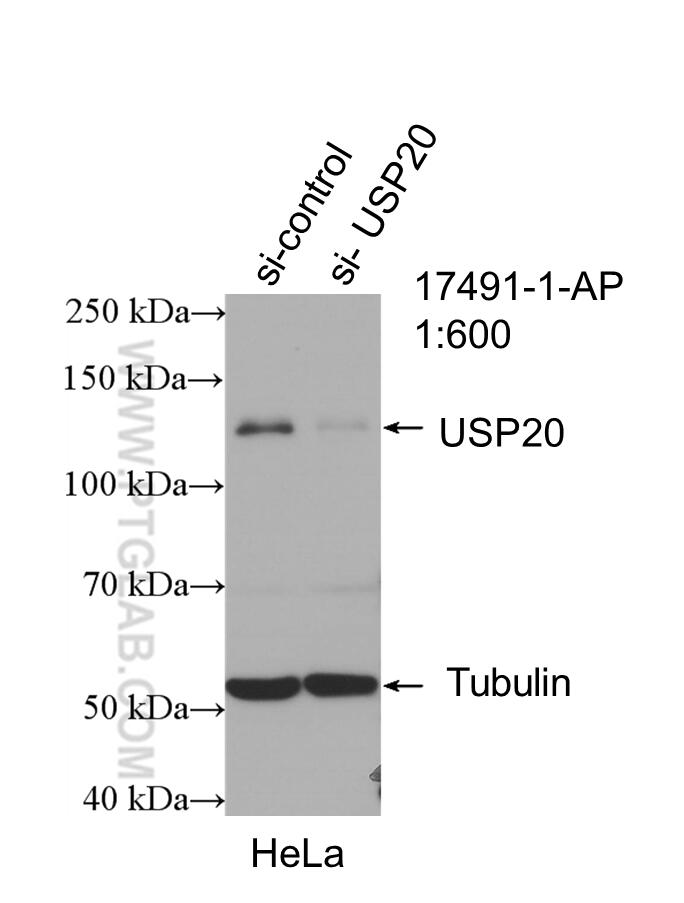 USP20 Antibody 17491-1-AP | Proteintech