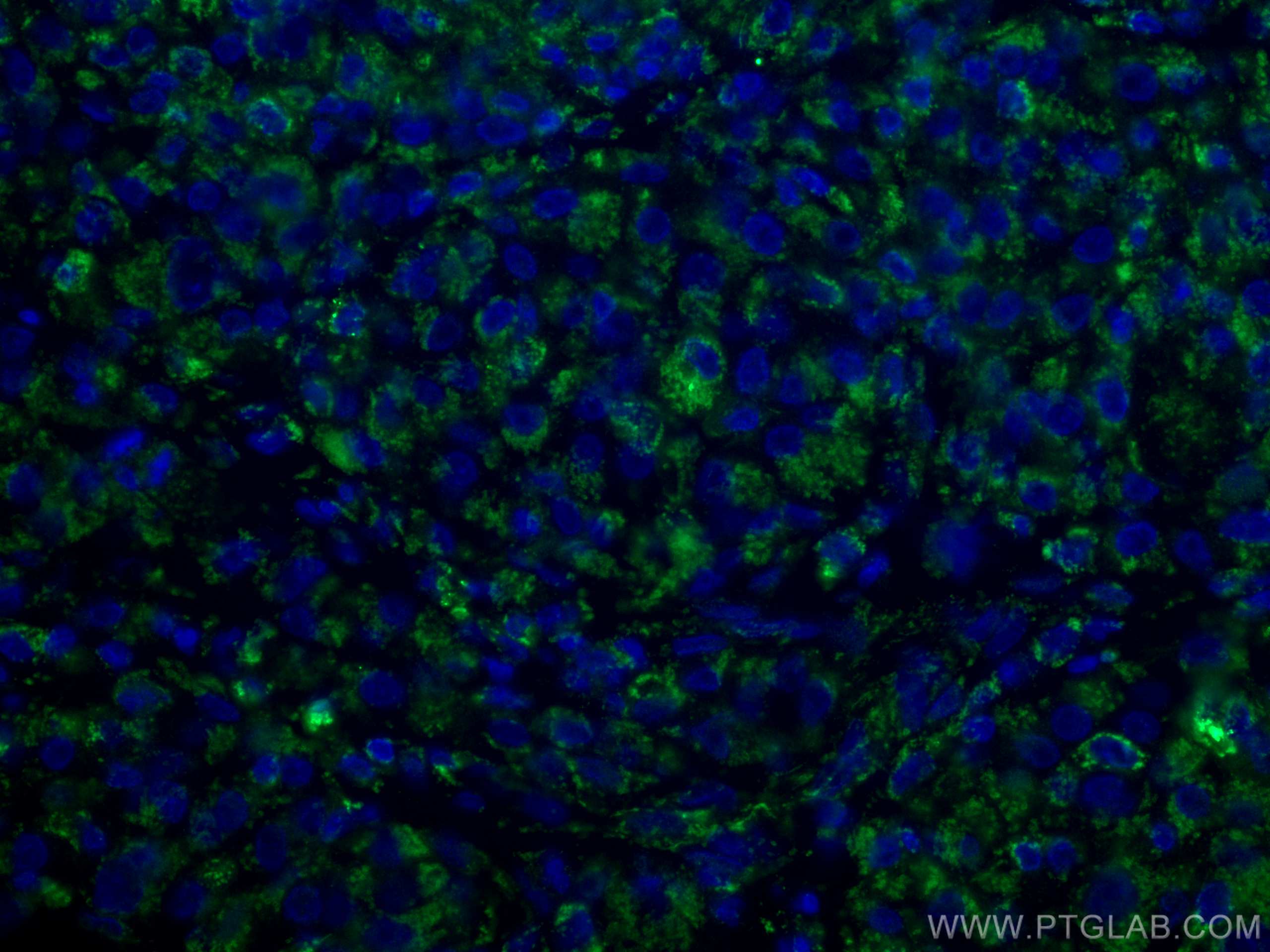 VDAC1/2 Antibody 10866-1-AP | Proteintech