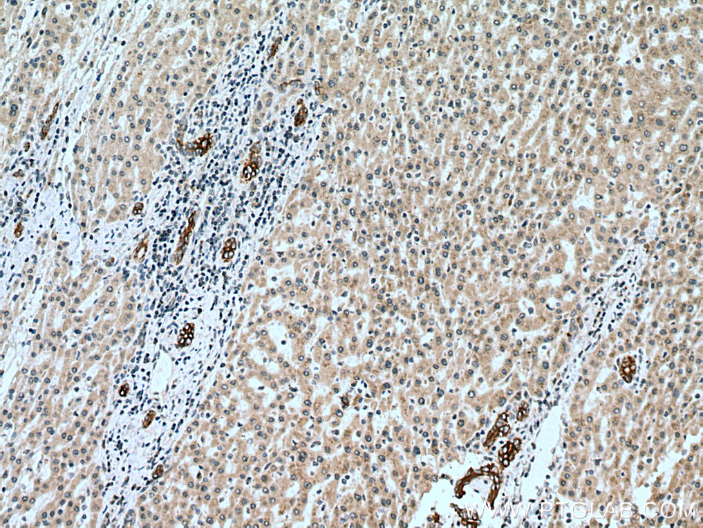 VEGFA Antibody 66828-1-Ig | Proteintech