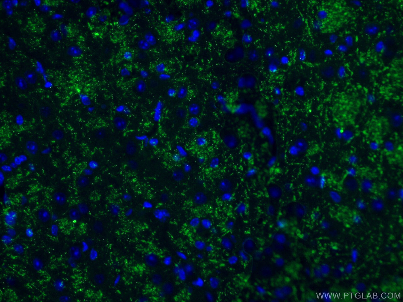 VGLUT2 Antibody 25261-1-AP | Proteintech