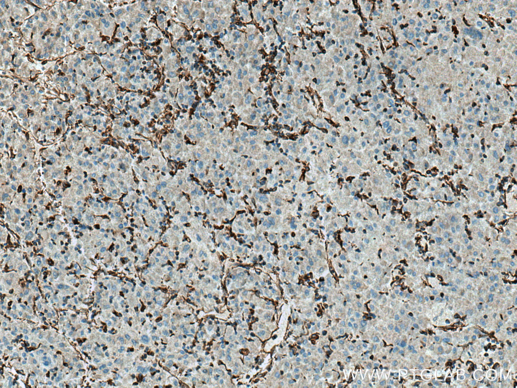 Vimentin Antibody 10366-1-AP | Proteintech