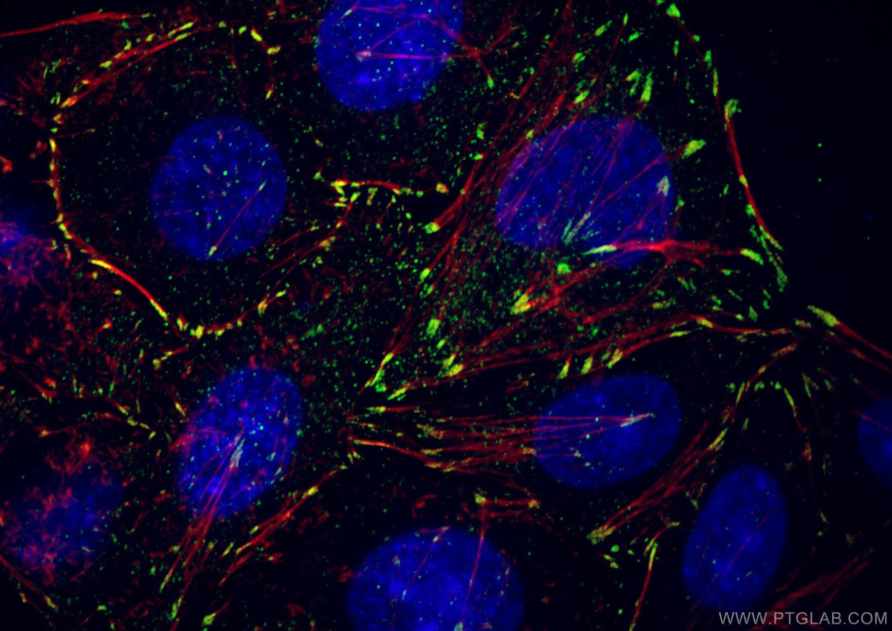 Vinculin Antibody 26520-1-AP | Proteintech