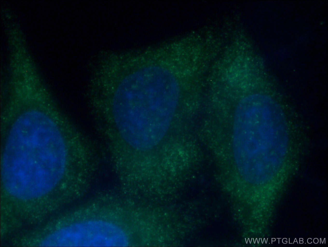 YTHDC2 Antibody 27779-1-AP | Proteintech