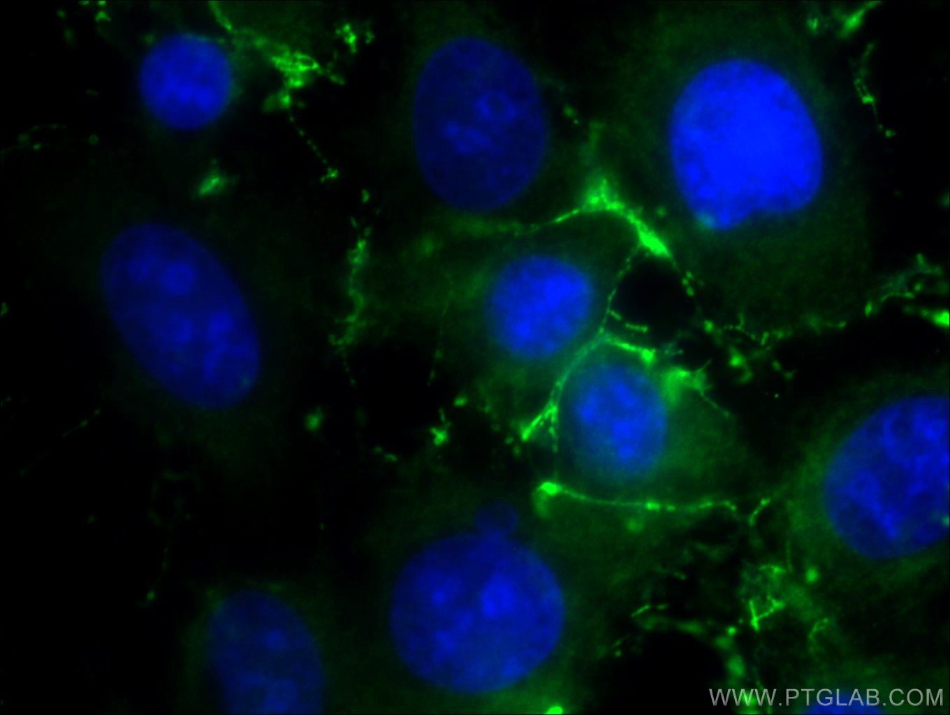 ZO-1 Antibody 20742-1-AP | Proteintech