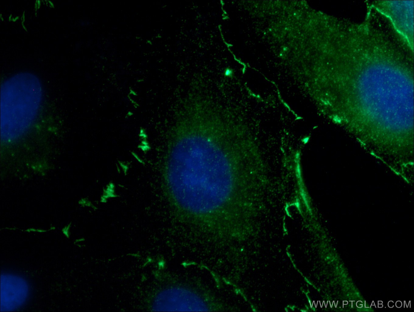ZO-1 Antibody 66452-1-Ig | Proteintech