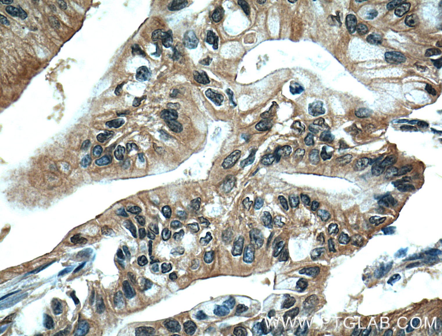 ZO-1 Antibody 66452-1-Ig | Proteintech