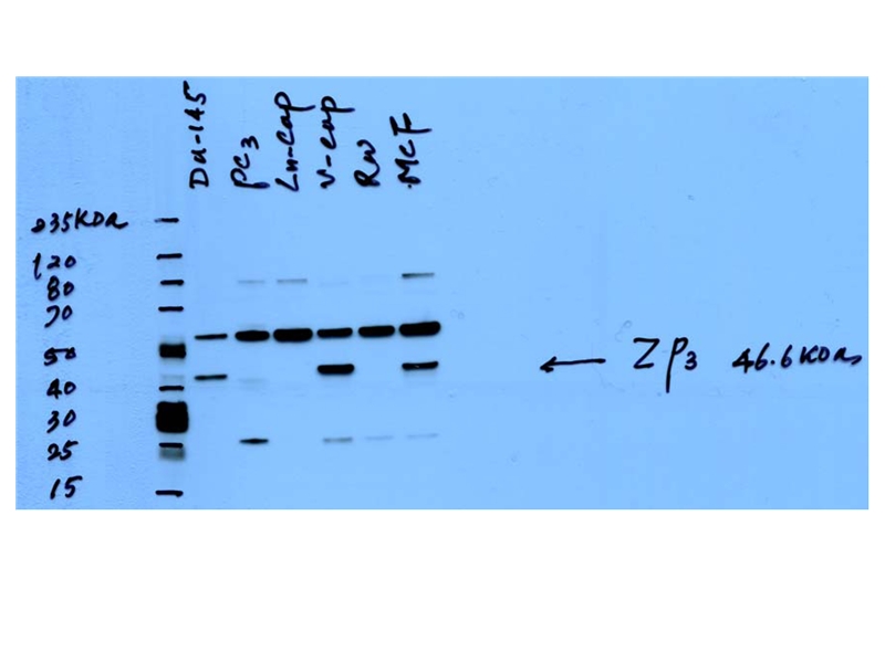 ZP3 Antibody 21279-1-AP | Proteintech
