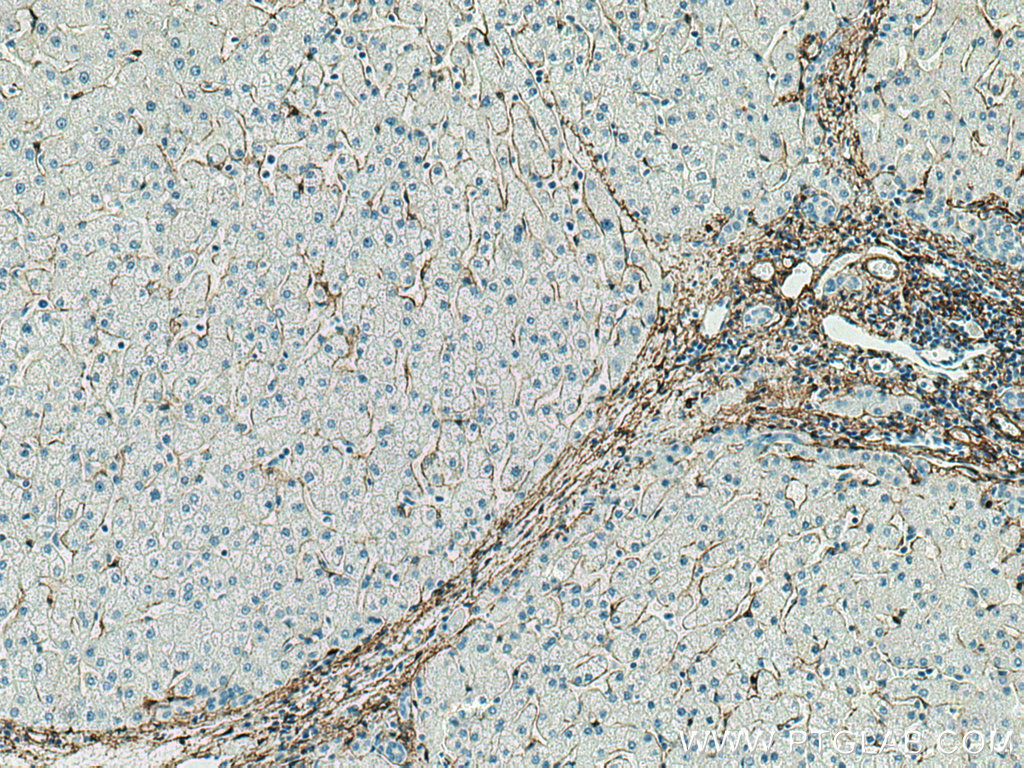 smooth muscle actin specific Antibody 80008-1-RR | Proteintech
