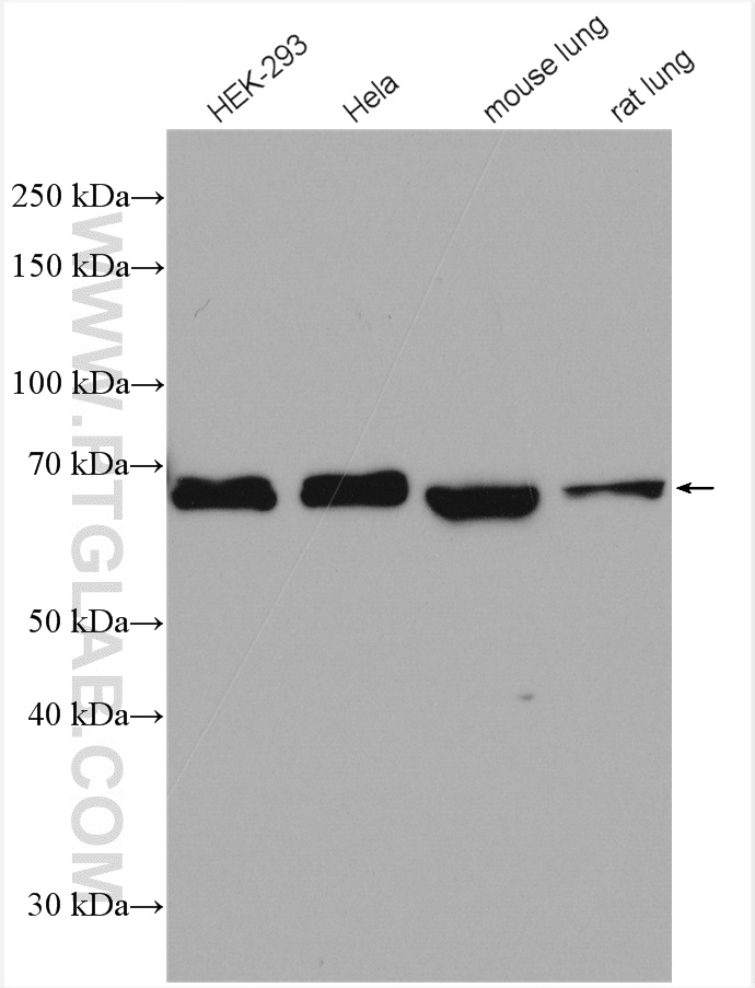NF-κB p65 Antibody 10745-1-AP | Proteintech