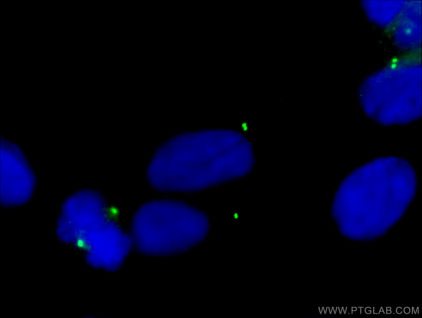 Gamma Tubulin Antibody 66320-1-Ig | Proteintech