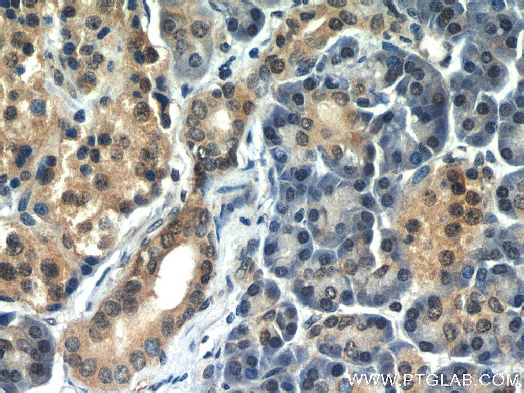 ubiquitin Antibody 10201-2-AP | Proteintech