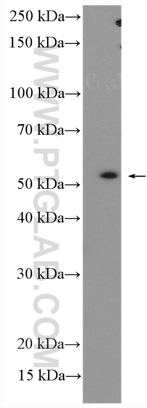 SLC7A11/xCT Antibody 26864-1-AP | Proteintech