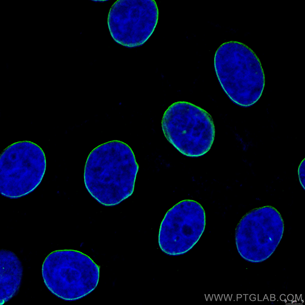 CoraLite Fluorescent Dye-Conjugated Antibodies | Proteintech Group