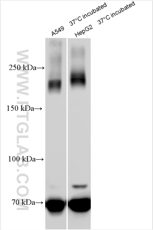 MRP2 antibody (29261-1-AP) | Proteintech | 武汉三鹰生物技术有限公司