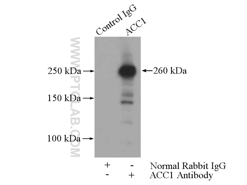 ACC1 antibody (21923-1-AP) | Proteintech