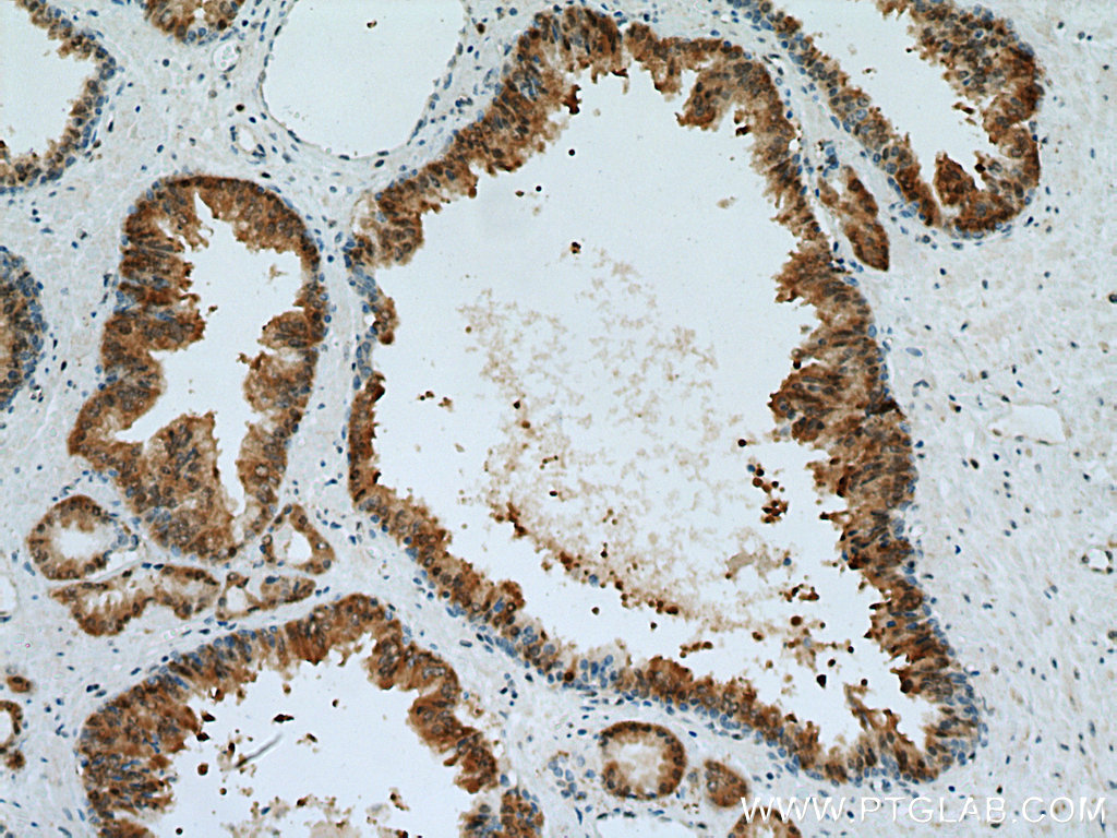 ACLY Antibody 67166-1-Ig | Proteintech