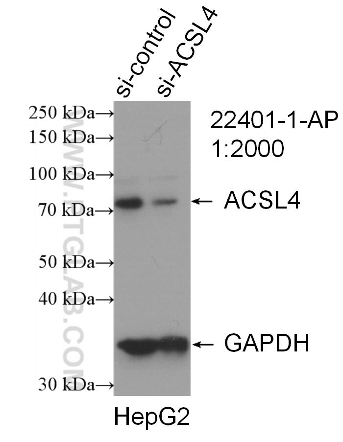 ACSL4/FACL4 antibody (22401-1-AP) | Proteintech | 武汉三鹰生物技术有限公司